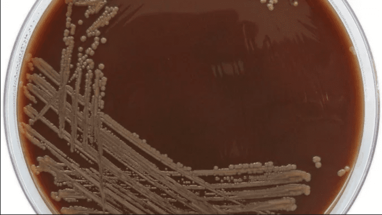 Haemophilus ducreyi: il batterio scoperto a Napoli - laCOOLtura